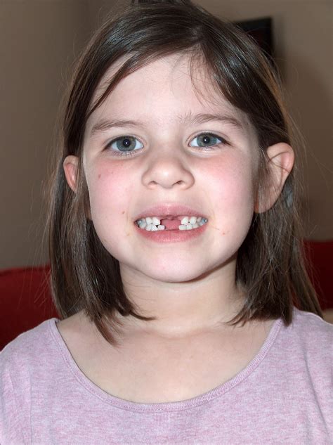 Postcards From A Mom On The Edge The Toothless Wonder