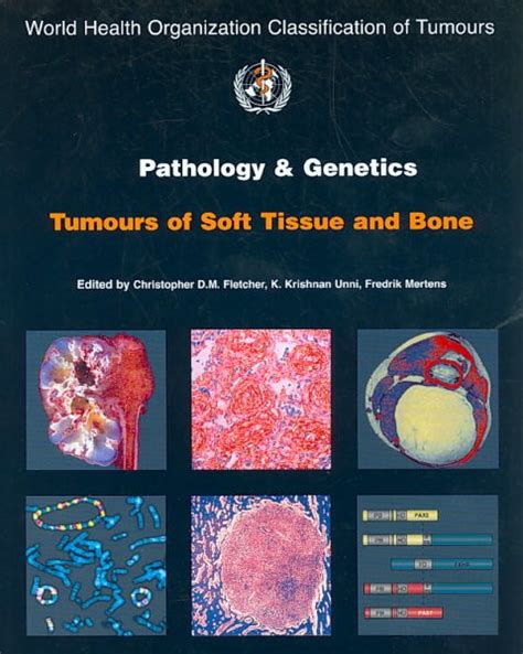 Pathology And Genetics Of Tumours Of Soft Tissue And Bone Iarc Who