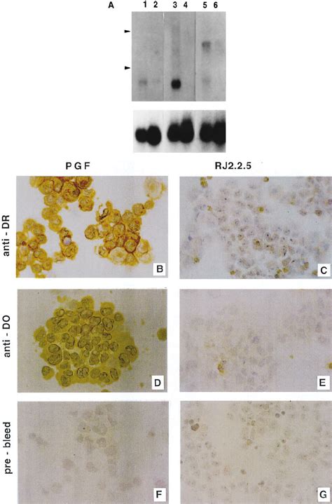 Hla Do Expression In The B Lymphoblastoid Cell Line Pgf And Class Ii
