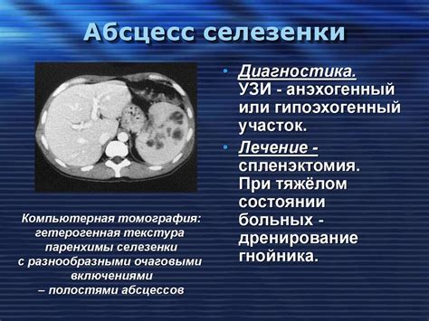 Хирургические заболевания селезенки - презентация онлайн