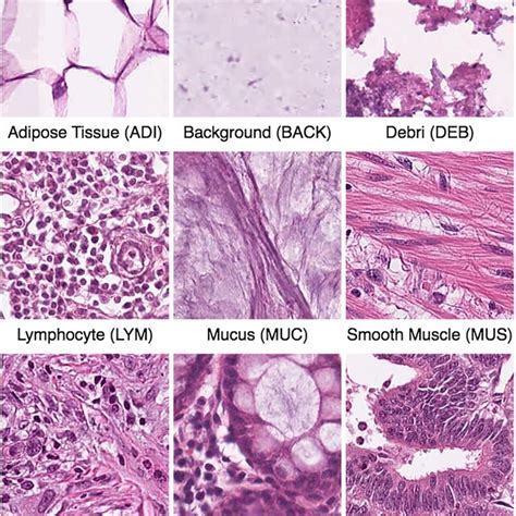 Image Tile Examples For Each Class In The Training Data Download