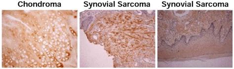 Osteocalcin Monoclonal Antibody Ocg4 50120 100ug