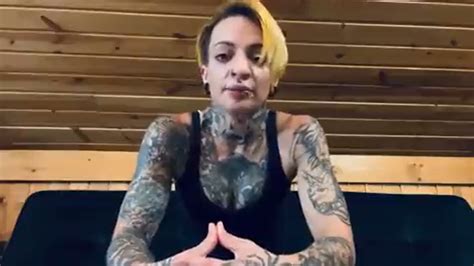 Ruby Soho Confirms Broken Nose Injury Set To Undergo Surgery