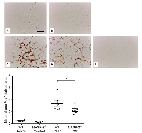 Figure 3 From Absence Of The Lectin Activation Pathway Of Complement Ameliorates Proteinuria