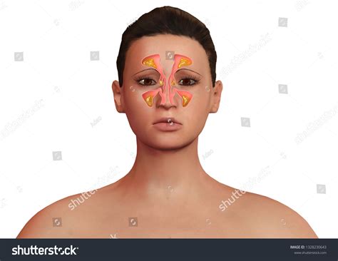 Face Woman Nasal Sinuses Inflamed Sinusitis Stock Illustration