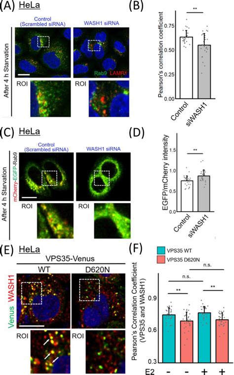 The Impact Of Vps35 D620n Mutation On Alternative Autophagy And Its Reversal By Estrogen In