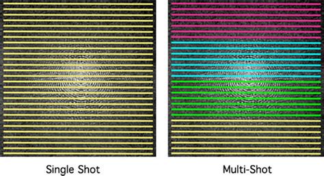 Echo Planar Imaging Epi Questions And Answers In Mri