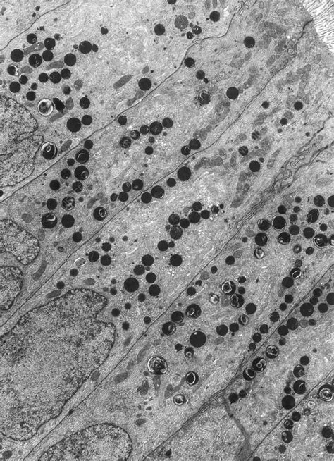 Lysosome Electron Micrograph