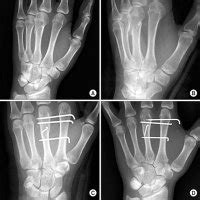 Jkoa The Journal Of The Korean Orthopaedic Association