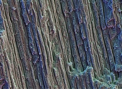 Tooth Dentine Sem Stock Image P4860073 Science Photo Library