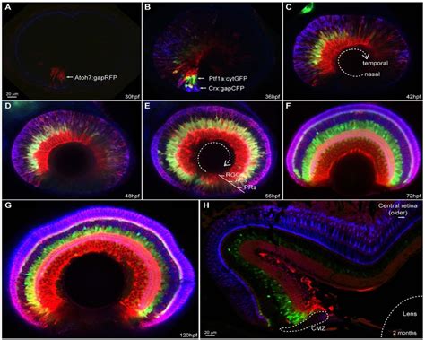 Sofa1 Spatial Temporal Expression Highlights The Retina Differentiation