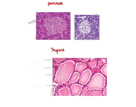 Pancreas And Thyroid Histology Quiz