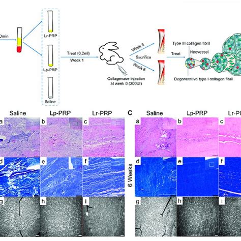 Effects Of Leukocyte Rich Platelet Rich Plasma Lr Prp And Download Scientific Diagram