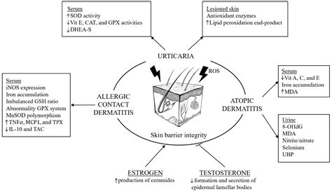Sex Differences In Oxidative Stress Concerning Allergic Diseases