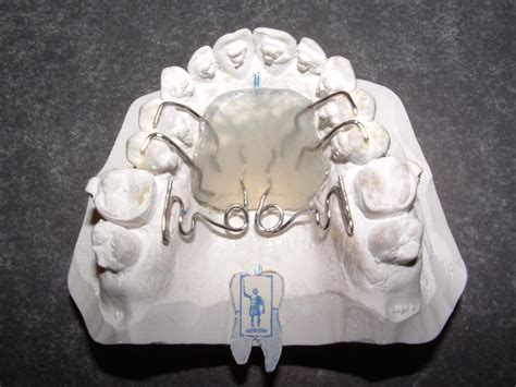 Pendulum Di Hilgers Ft 1 Odontotecnica Bardulos