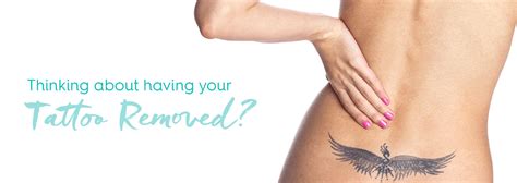 Laser Tattoo Removal In Miami Fl Arviv Medical Aesthetics