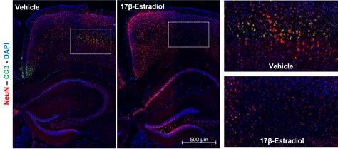Estrogen May Offer Protection Against Delirium