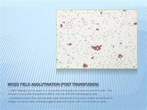What Causes Mixed Field Agglutination Elaci