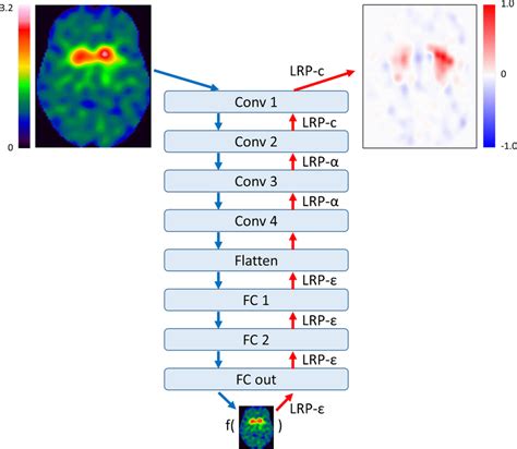 Structure Of The Custom Cnn For Binary Classification Of Dat Spect