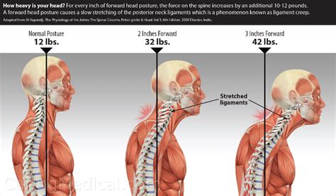 Reverse Slouching Posture Exercises To Improve Posture Bytkck