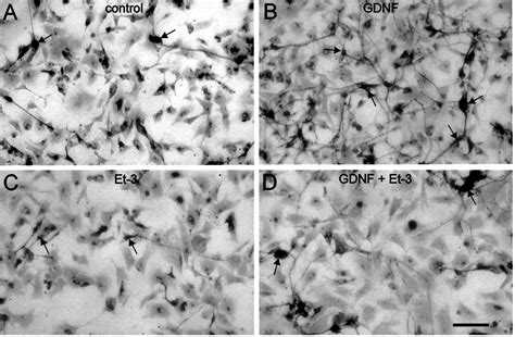 Dissociated Enteric Precursor Cells From E47 Quail Gut Grown For 4 Download Scientific Diagram