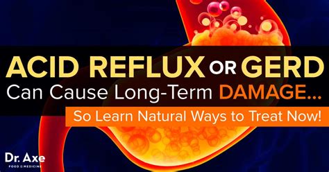 Acid Reflux Hiccups Cure Chronic Hiccups Causes Treatments And