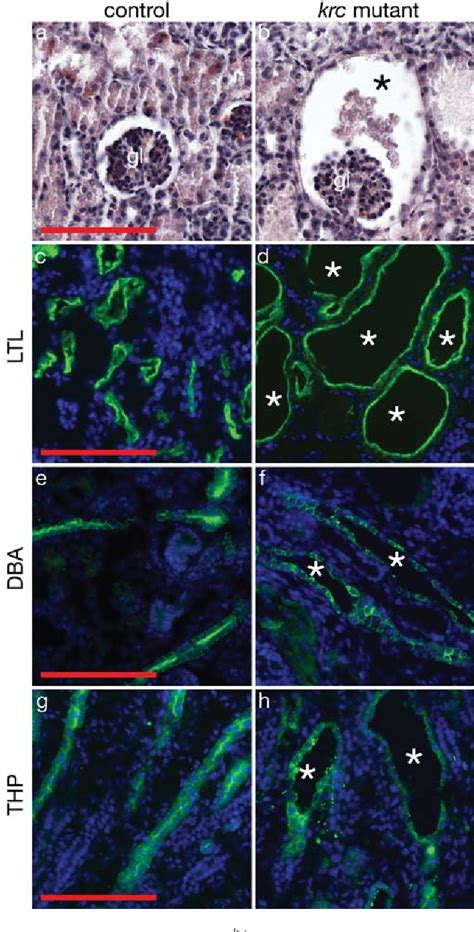 Figure 2 From A Mouse Model For Meckel Syndrome Reveals Mks1 Is
