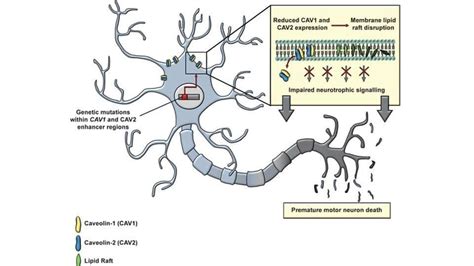 Motor Neuron Disease Mnd Treatment With Stem Cells Swiss Medica