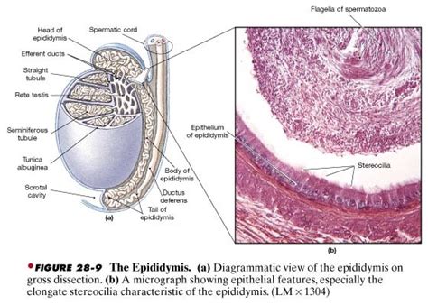 Diagrammatic View Of The Head Body And Tail Of An Epididymis Diagram