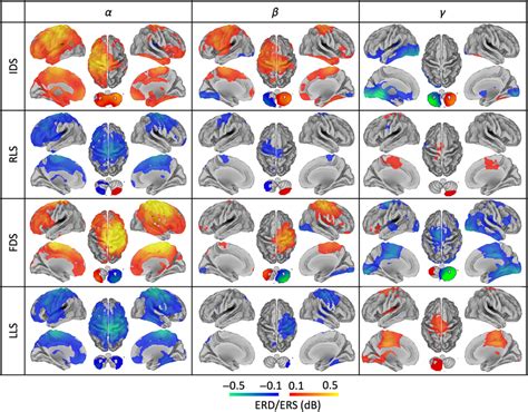 event‐related desynchronization synchronization erd ers maps for