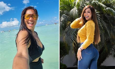 Katia Palma Hace Fuerte Revelación Tras Someterse A Liposucción ¡mi