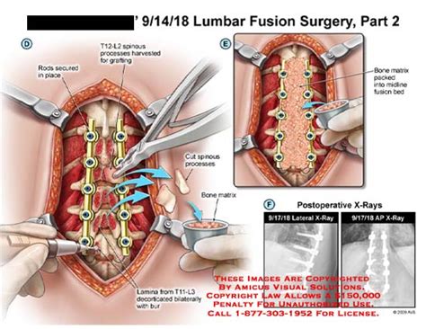 Medical Exhibits Demonstrative Aids Illustrations And Models