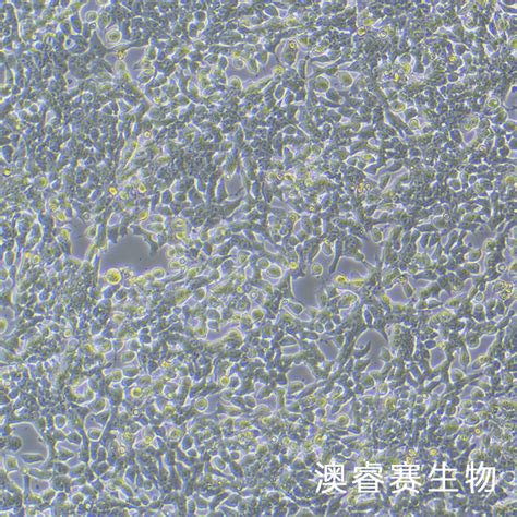 Mn9d 小鼠中脑多巴胺能神经元细胞细胞系澳培赛生物科技（上海）有限公司 专业细胞生物学供应商