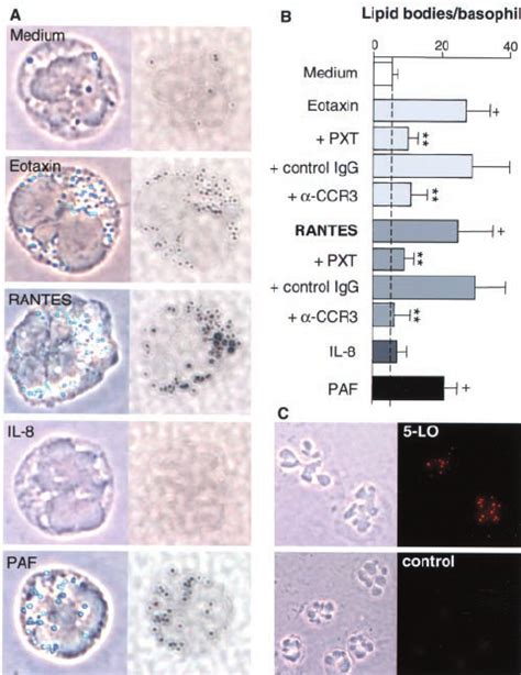 A Much Of The Staining Was In A Linear Perinuclear Pattern Although