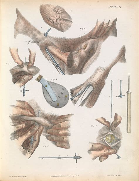 Plate 71 Surgical Anatomy Perineum Free Photo Illustration Rawpixel