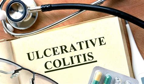 Ulcerative Colitis Vs Crohns Disease Key Differences Explained
