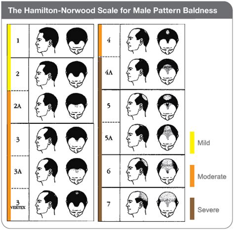 The Hamilton Norwood Scale For Male Pattern Baldness