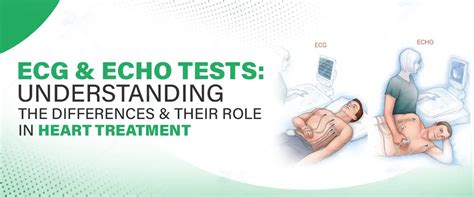 Ecg And Echo Tests Understanding The Differences And Their Role In Heart Treatment