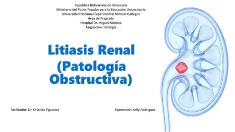 Renal Lithiasis Management Kelly Francheska Udocz