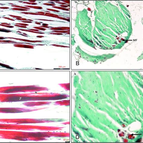 The Photomicrographs Of Longi Tudinally Sectioned Lumbrical Muscles The Photomicrographs Of Longi Tudinally Sectioned Lumbrical Muscles