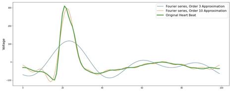 Example Of Kernel Cross Correlation Of Ecg Data With A Pre Computed Download Scientific Diagram