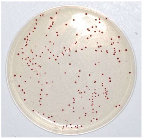 Two Screening Assays To Detect Vancomycin Resistant Enterococcus Spp