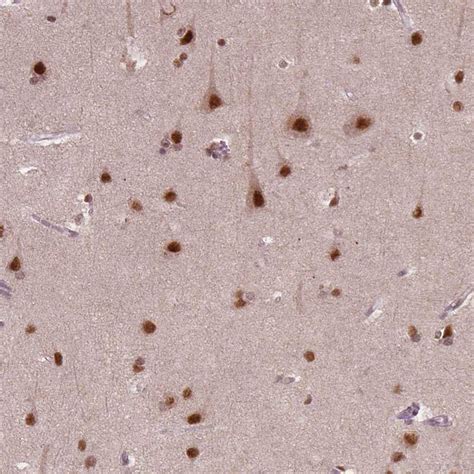 Mouse Monoclonal Anti Nsd2 Antibody Buy For Research Highly