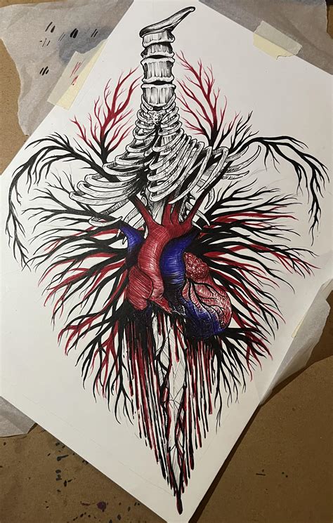 Pe Art Stuff Yea I Dont Know What Happened Rpectusexcavatum