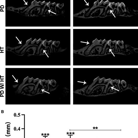 The Periodontitis Model Was Successfully Constructed By Oral Bacterial Download Scientific