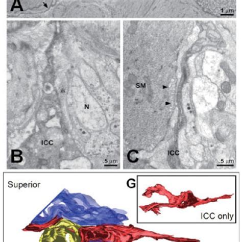 Distribution Of Icc Revealed By Immunohistochemical Staining With C Kit