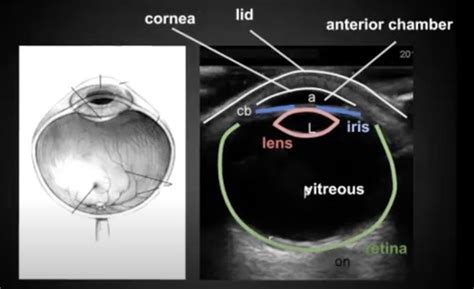 Eye And Neck Pocus Flashcards Quizlet