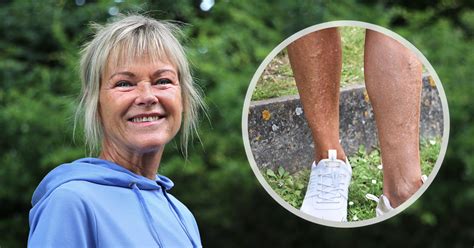 Wellvita Hulp Voor Mijn Blauwe Aderen En Zware Benen Milled