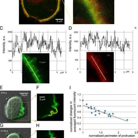 Cortex Periodic Structure And Estimation Of Membrane Cortex Compaction