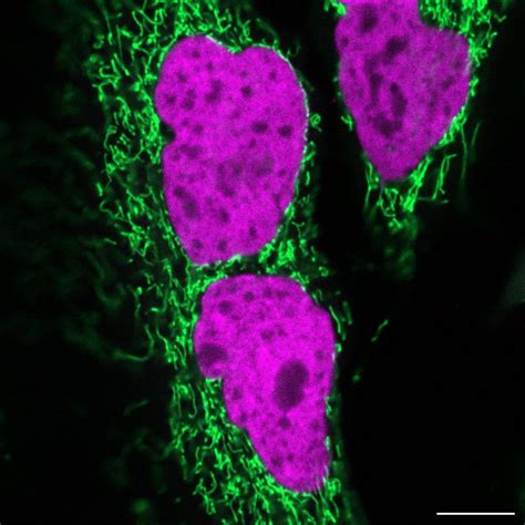 Probes 101 How To Choose A Fluorescent Probe For Your Imaging Experiment Focalplane